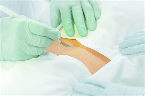 GP audit developed to 'prove value' of practice-based minor surgery